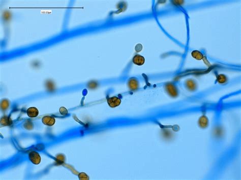 Fun With Microbiology Whats Buggin You Stemphylium Species