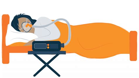 CPAP Alternatives Other Ways To Relieve Obstructive Sleep Apnea