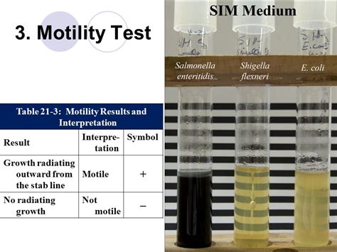 Ex 21 Sim Medium Sulfur Indole Motility Ppt Video Online Download