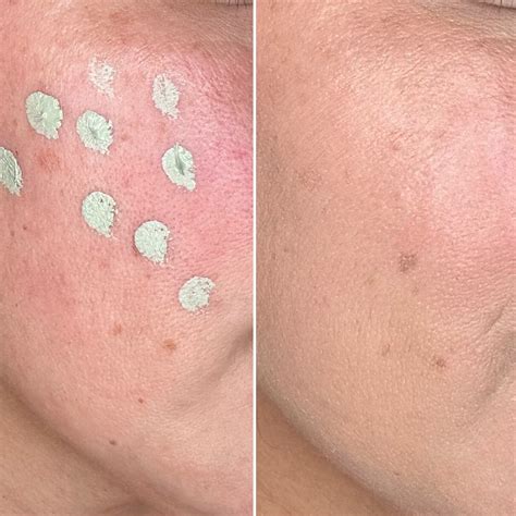 Why I Ditched Concealer For These Color Correctors