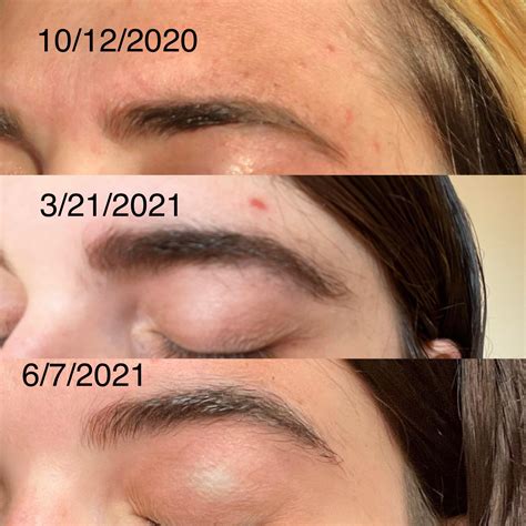 Been On A Journey Of Fading My Micro Blading While Also Recovering From