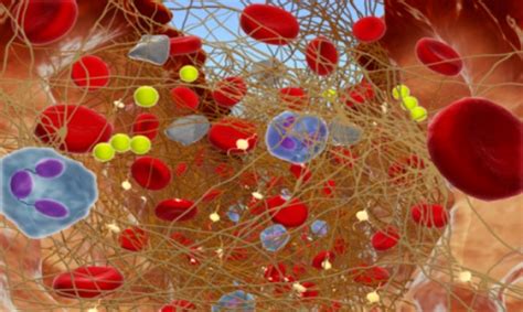 Video Randomized Trial Of Prophylactic Platelet Transfusions Transfusion News