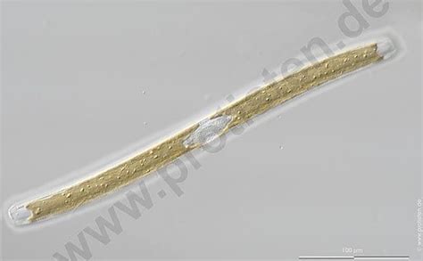 Nitzschia Sigmoidea020 125 23283532dtk Nitzschia Sigmoi Flickr