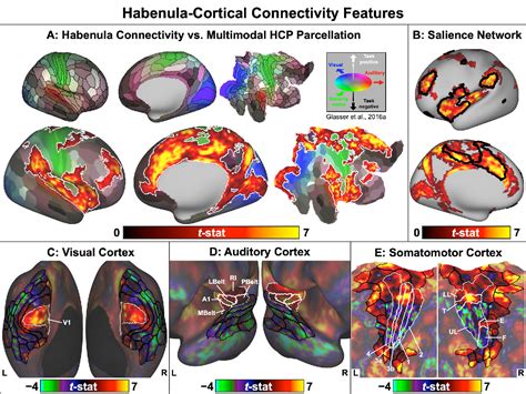 Figure 5 From Detailed Mapping Of Human Habenula Resting State