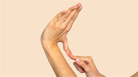 Marfan Syndrome Hands X Ray