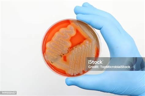 抗生物質耐性細菌感染症の増加細菌培養皿を持つ医師または研究者の手 シャーレのストックフォトや画像を多数ご用意 シャーレ カットアウト