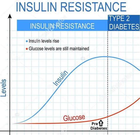Reactive Hypoglycemia And Insulin Resistance R Hypoglycemia