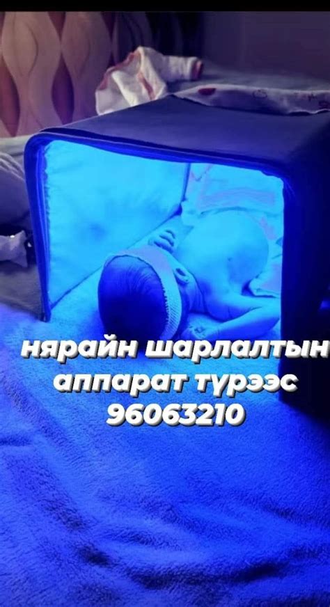 Нярайн шарлалтын аппарат түрээс НИСЭХ яармаг