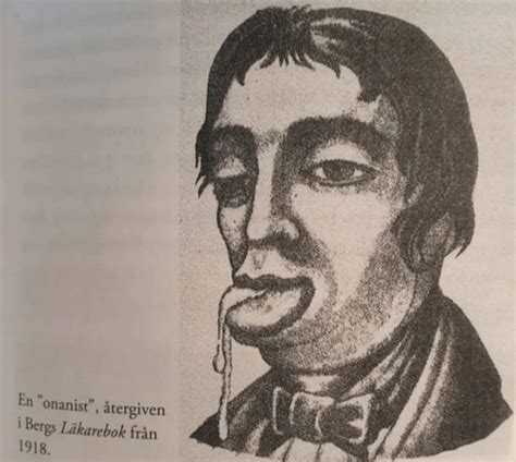 Picture Of A Masturbater From A 1918 Swedish Medical Textbook Rweird