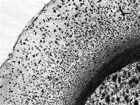 44 Questions With Answers In Golgi Staining Science Topic