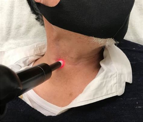 Sgp Using Linearly Polarised Near Infrared Light A Linear Polarised Download Scientific