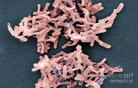 Clostridium Difficile Sem Photograph By Science Source Fine Art America