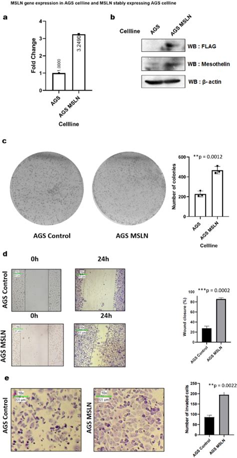Mesothelin Promotes Oncogenic Properties In Gastric Cancer Cell Line