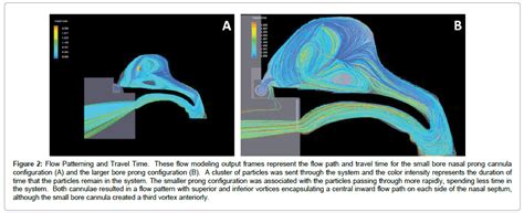 Computational Fluid Dynamics Modeling Of Extrathoracic Airway Flush Evaluation Of High Flow