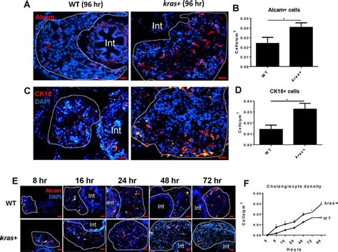 Increase Of Cholangiocytes Upon Induction Of Oncogenic Kras V12 Download Scientific Diagram