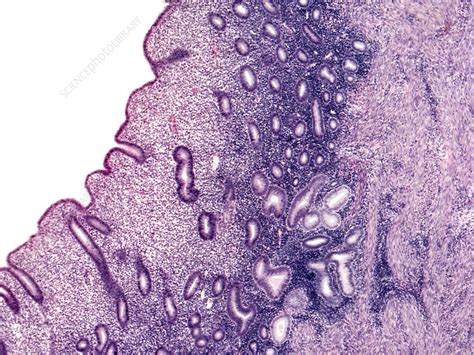 Human Uterus Light Micrograph Stock Image C055 6356 Science Photo Library