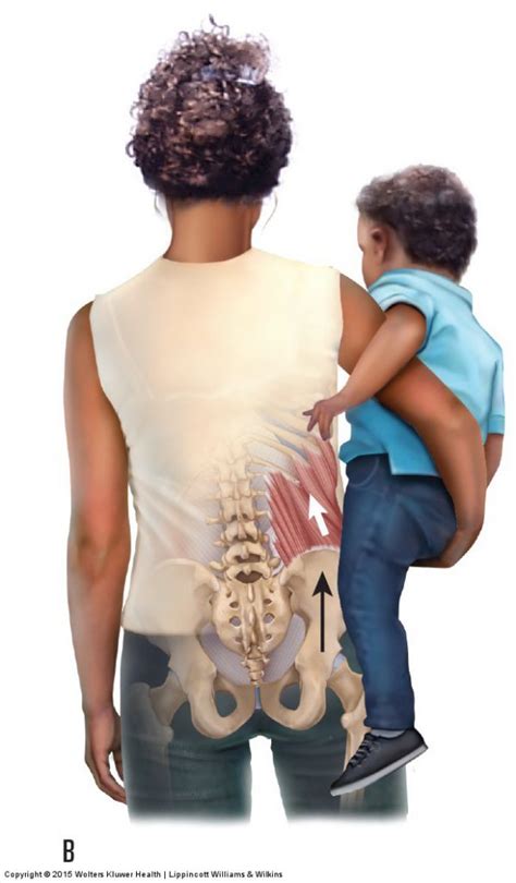 Hypertonic Tight Muscles Of The Low Back And Pelvis