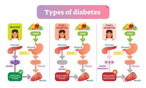 The Difference Between Type 1 And Type 2 Diabetes Health Beathealth Beat