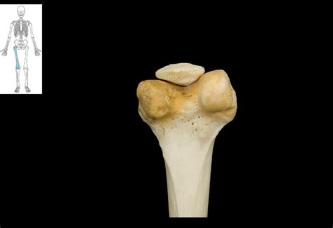 Articulated Right Femur And Patella Inferior Posterior View Diagram