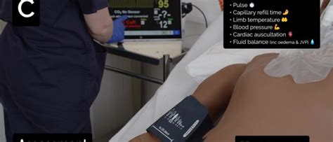 Abcde Assessment Osce Guide Checklist Geeky Medics