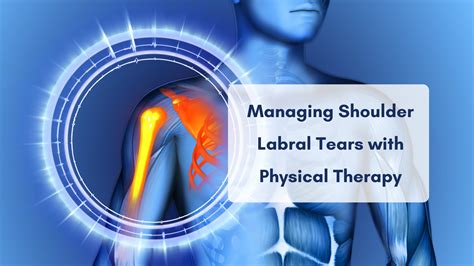 Managing Shoulder Labral Tears With Physical Therapy Mangiarelli