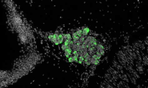 Neuroendocrine Cell Type Diversity — The Gillis Lab
