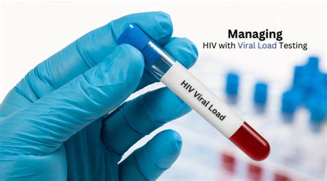 understanding hiv viral load importance testing and treatment