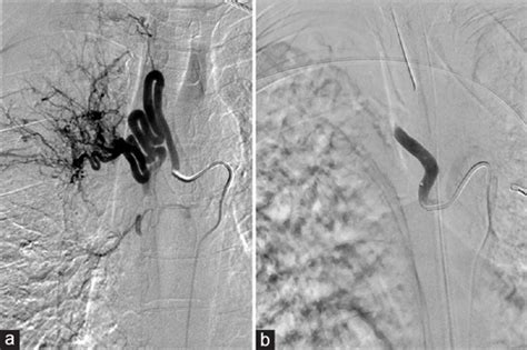 Dr Bhupendra Bathala