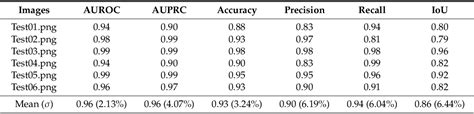 Table 2 From Automatic Coal And Gangue Segmentation Using U Net Based