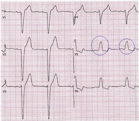 EKG očima záchranáře PDF Free Download