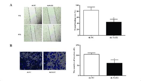 NAT2 Knockdown Suppresses Migration And Invasion Of CRC Cells A The