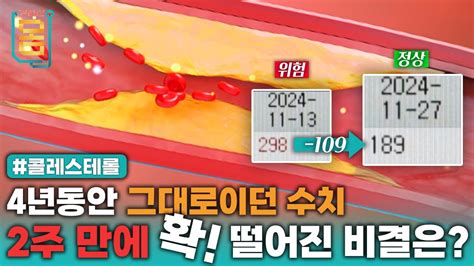 Full 4년동안 그대로이던 수치 2주 만에 확 떨어진 비결은 콜레스테롤ㅣ귀하신 몸ㅣ82화 2주의 도전 콜레스테롤