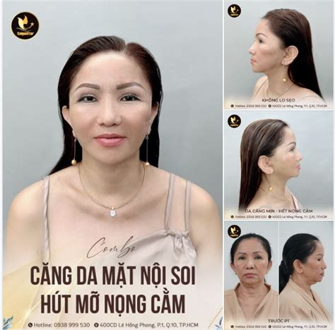 Kh ViỆt KiỀu MỸ ThÀnh CÔng LẤy LẠi 10 NĂm TuỔi XuÂn CÙng Combo TrẺ