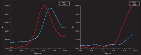 Examples Of Aif And Vof Truncation Example Of Normal Aif Curve With Download Scientific