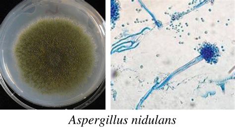 Aspergillus Morphology Clinical Features And Lab Diagnosis • Microbe