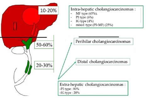 Localization Distribution And Frequency Of The Macroscopic Type Of
