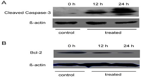 SGC 7901 cells were exposed to 40 μM of Costunolide for specified time