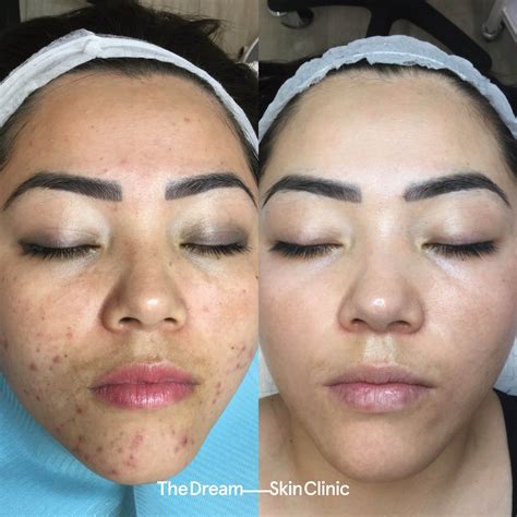 The Dream Skin Clinic