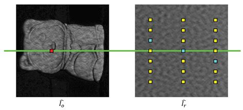 semi global matching assisted absolute phase unwrapping