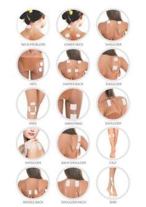 Tens Pad Placement Guide Jointpainrelief Tens Pads Tens Machine