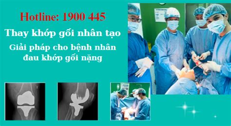 Thay Khớp Gối Nhân Tạo Những Thông Tin Bổ ích BỆnh ViỆn Đa Khoa