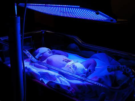 Rebound Bilirubin Checks Before Discharge