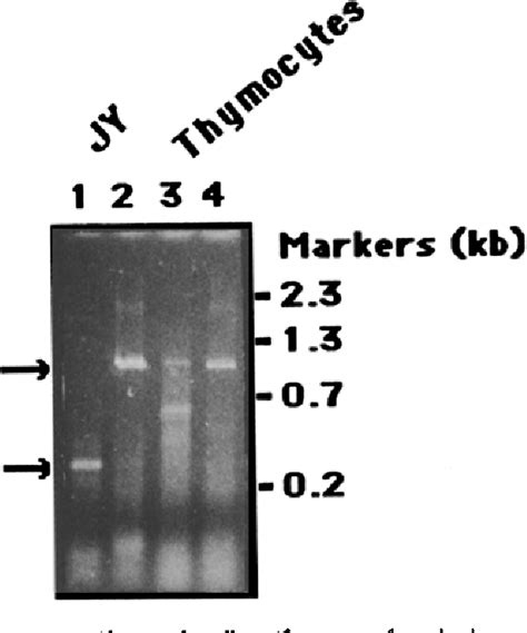 Figure 1 From Infection Of Human Thymocytes By Epstein Barr Virus