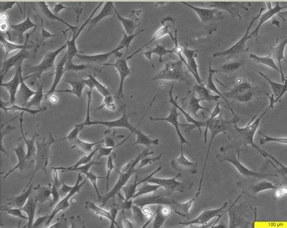 MEF ULK1 ULK2 DKO SV40 Cell Line Cell Lines Ximbio