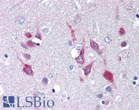 Ihc Plus™ Cacna1c Cav12 Polyclonal Antibody Rabbit Ihc Lsbio