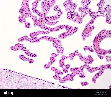 Plexus Choroideus Stockfotos Und Bilder Kaufen Alamy