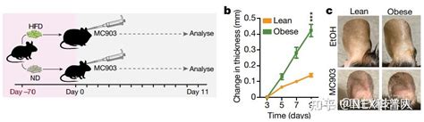 Nature：肥胖不仅加重了炎症病理学，还会抵抗治疗反应 知乎