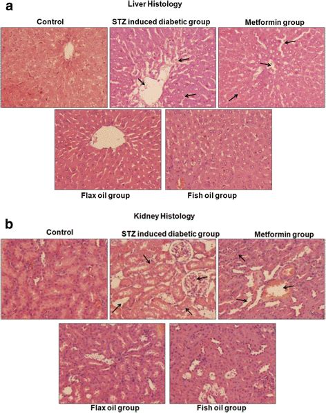 A Liver Histology Of Control Stz Induced Diabetic Metformin Treated