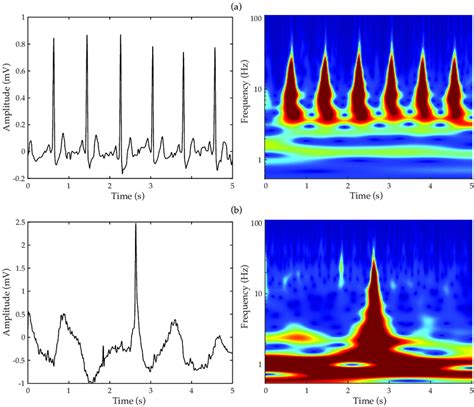 Example Of Typical 5 S Length Ecg Intervals From The A High And B