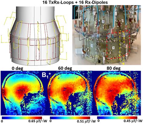 nmr in biomedicine vol 35 no 10